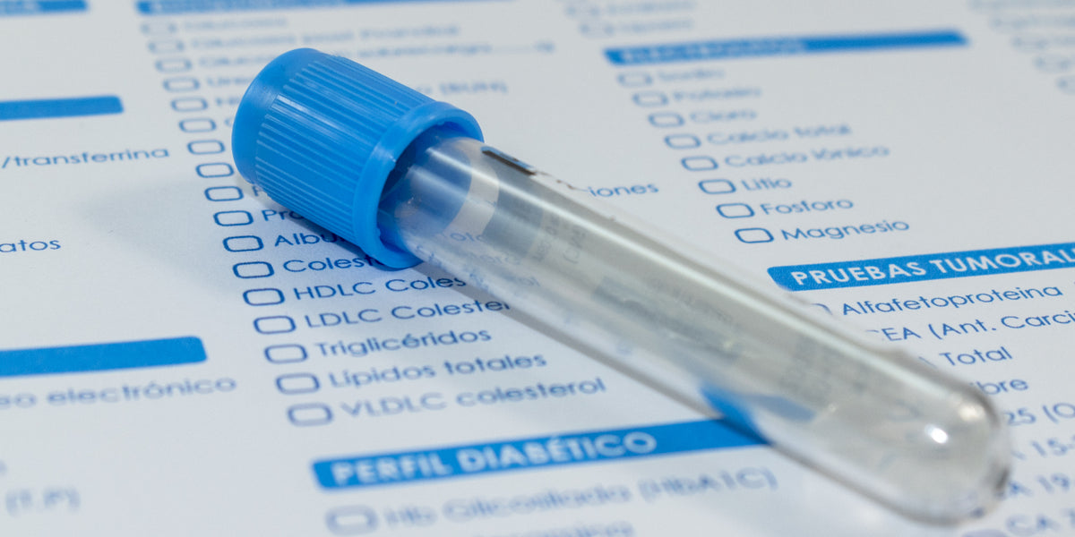 How Our Process Ensures Your Lab Results Are Accurate — RSC Health