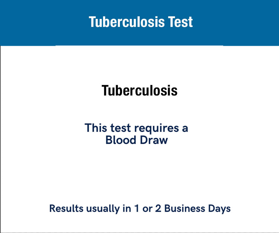 Tuberculosis Test — RSC Health